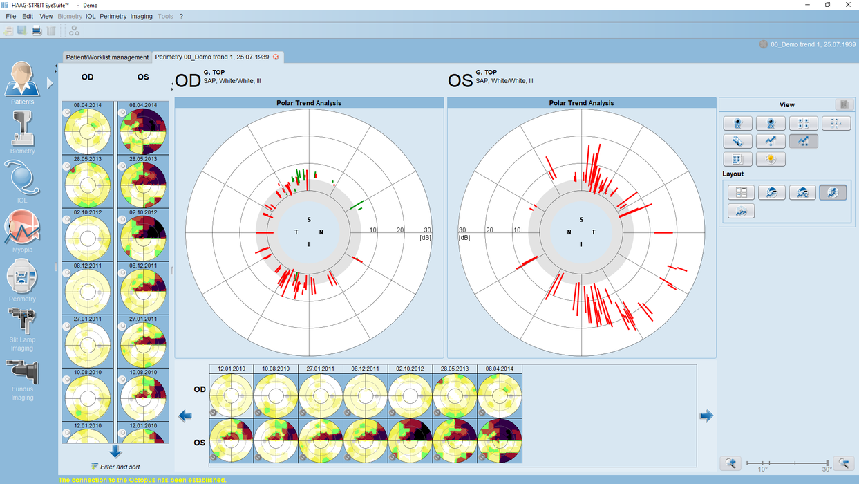 Octopus 900 - EyeSuite glaucoma analysis